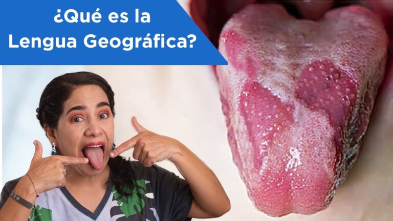 Descubre cómo identificar y tratar las fotos de manchas en la lengua ...