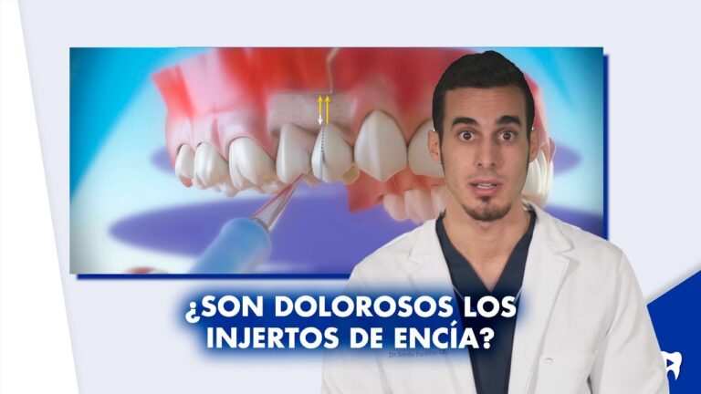 Injerto de encía: Mitos sobre el dolor y cómo minimizarlo - Rayan Clinic