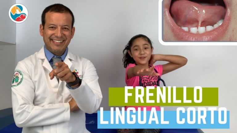 Descubre la importancia y funciones del frenillo de la boca: ¿Para qué ...
