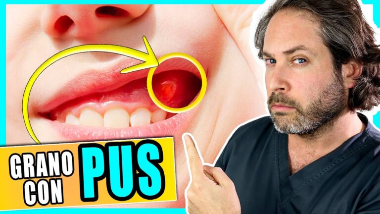 ¿Por qué me salió una bola en el cachete? Descubre las posibles causas ...