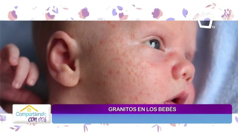 Descubre por qué salen granos a los bebés: causas y tratamientos ...