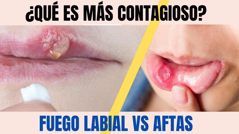 Descubre las causas y tratamientos para saber por qué salen heridas en ...