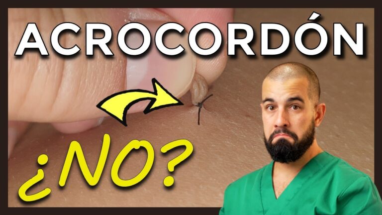 Descubre los 5 tipos de fibromas en la piel que debes conocer - Rayan ...
