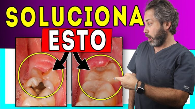 ¿Qué hacer ante una bolita en la muela del juicio? Guía completa para ...