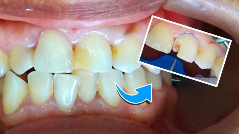 Descubre todo sobre la cavidad dental: la estructura que alberga tus ...