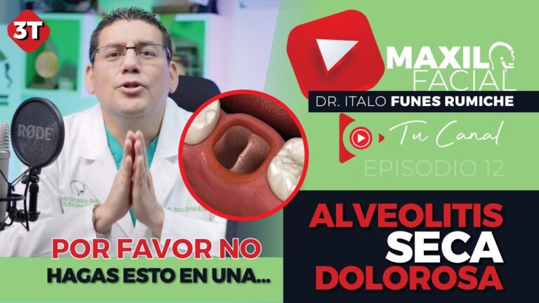 Descubre los 5 mejores métodos para calmar el dolor de la alveolitis de forma efectiva - Rayan ...