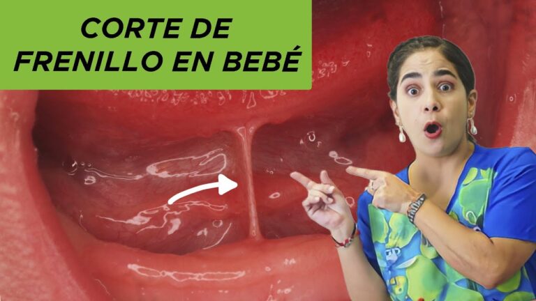 Todo lo que necesitas saber sobre cómo se ve el frenillo en bebés: Guía ...