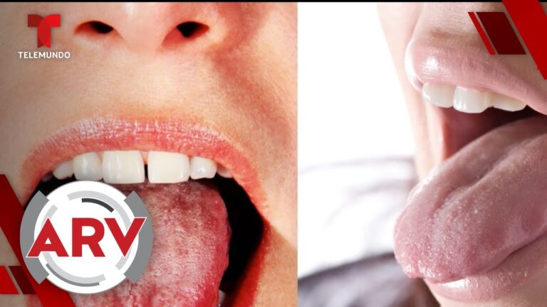 Descubre las enfermedades de la lengua humana: fotos impactantes y ...