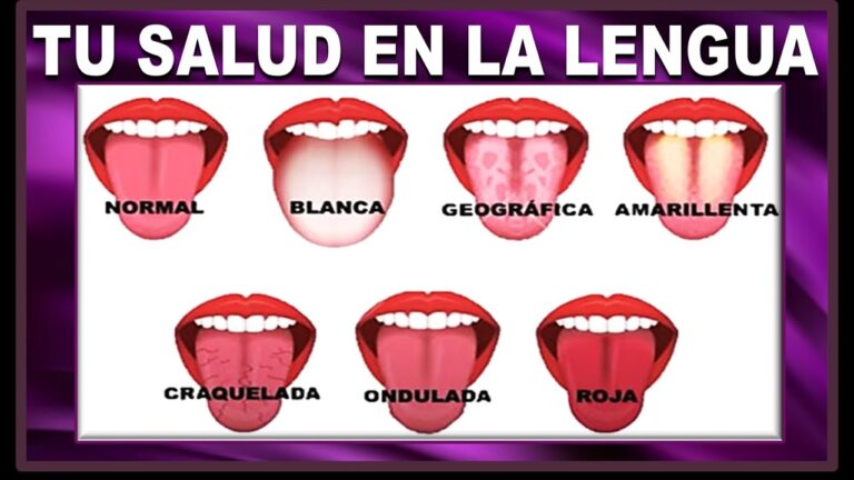 Enfermedades de la lengua: Síntomas, causas y tratamiento que debes ...