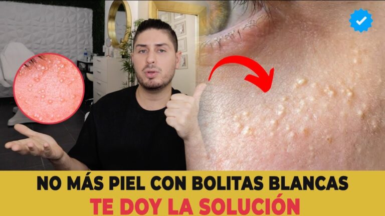 Todo lo que debes saber sobre los granitos en los cachetes por dentro ...