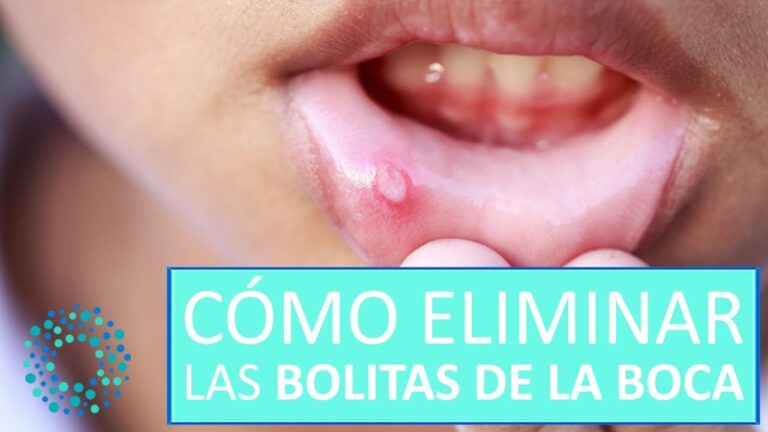 Descubre las causas por las que sale una bolita en el labio y cómo ...