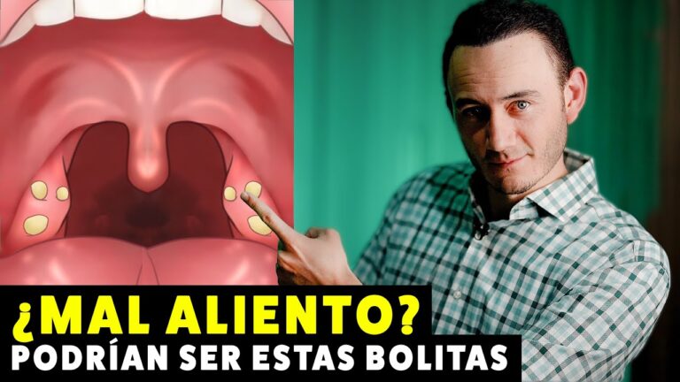 Descubre por qué salen bolitas en la garganta y cómo tratarlas de forma ...