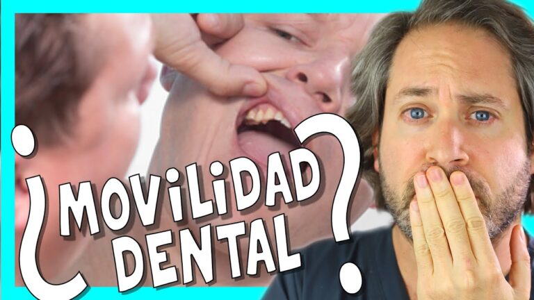 Qué hacer si se mueve una muela: Causas y soluciones para este problema ...